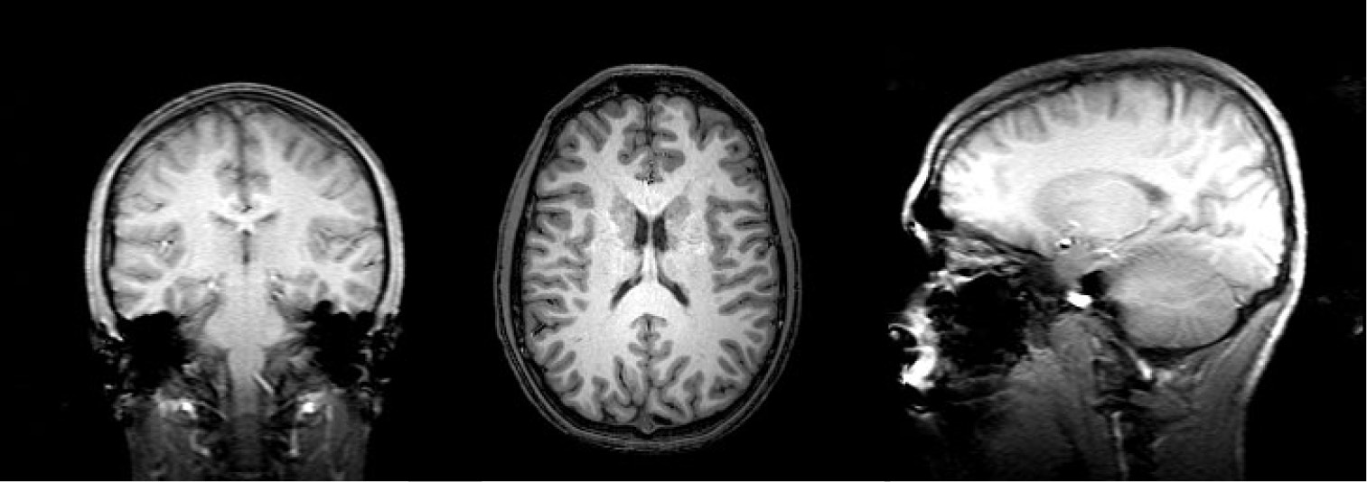 Personal CT Brain Scan / my brain - Database Projects