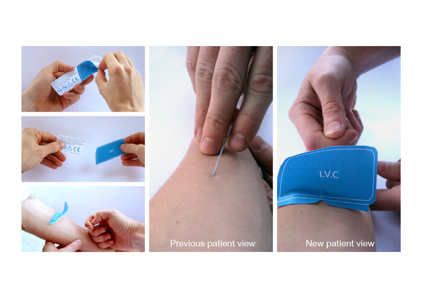 Case Study // Cannula Redesign - Luke Dixon