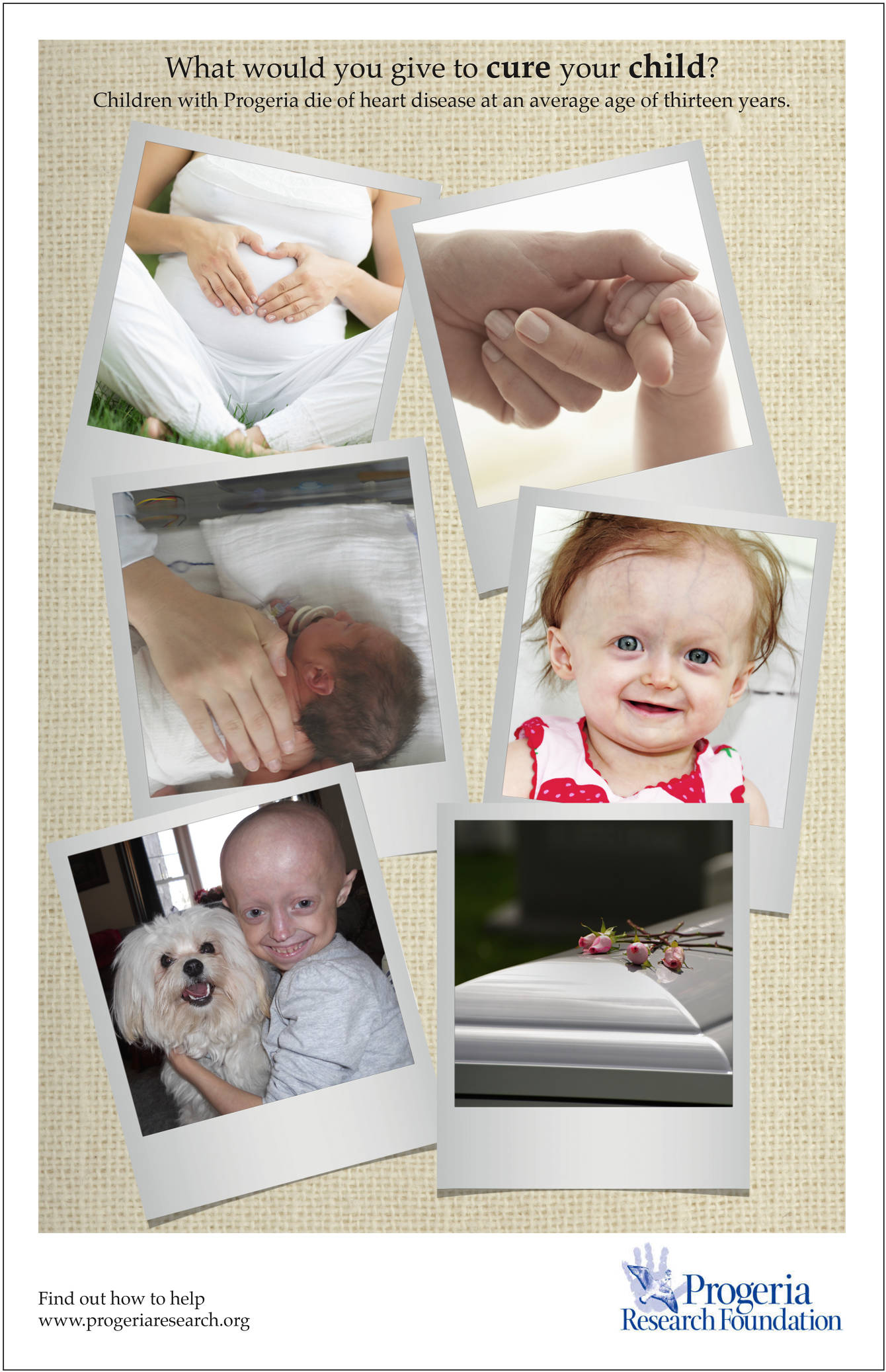 Progeria Research Foundation - Molly Cummings