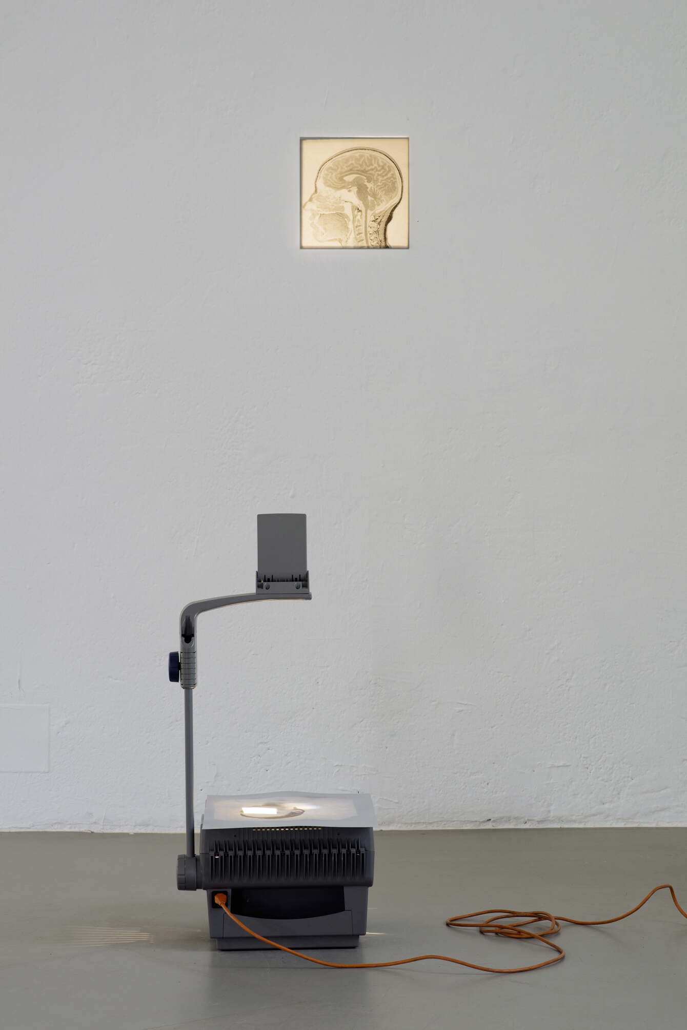 ALL MATTER BREAKS DOWN UNDER THE RIGHT PRESSURE - Alex Beriault