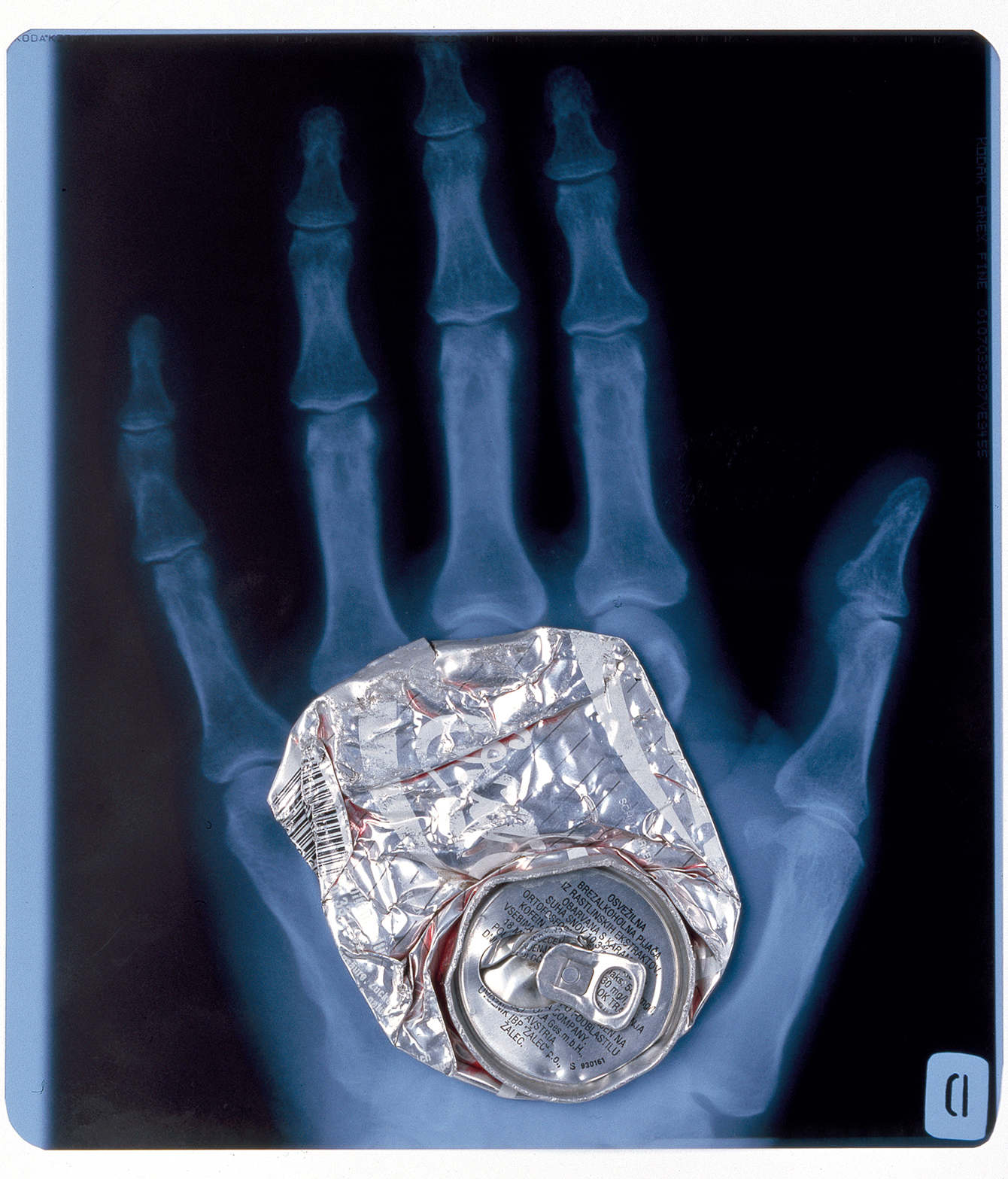 X-Ray Art - Stane Jagodič