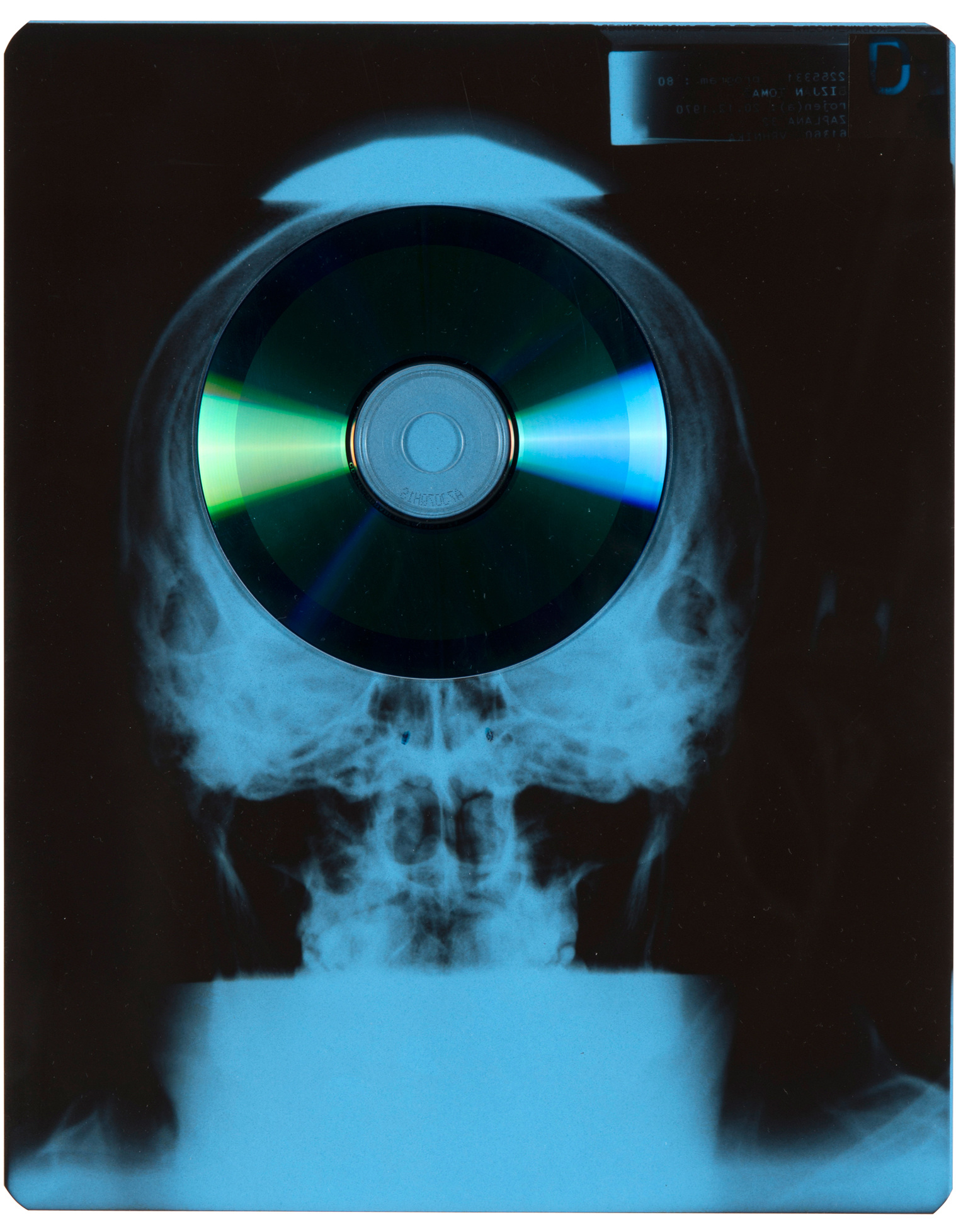 X-Ray Art - Stane Jagodič