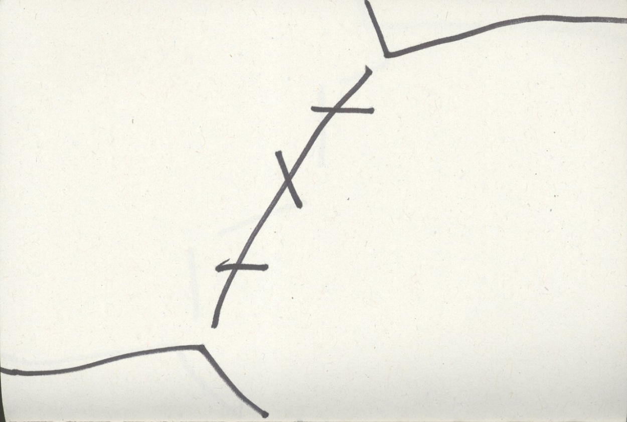 Vial series 1 ; Episode 6, Pen Drawing on Paper, 2013 - Siwon Ghim(Kim)