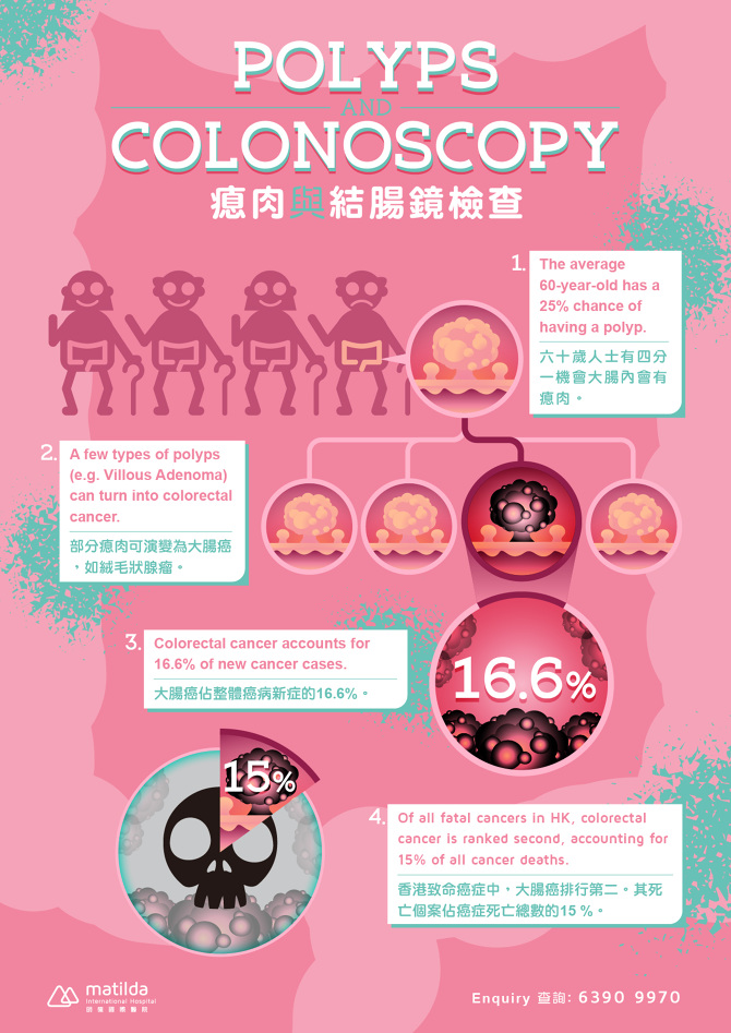 design/2019/infographics - Polyps and colonoscopy - leo cheung