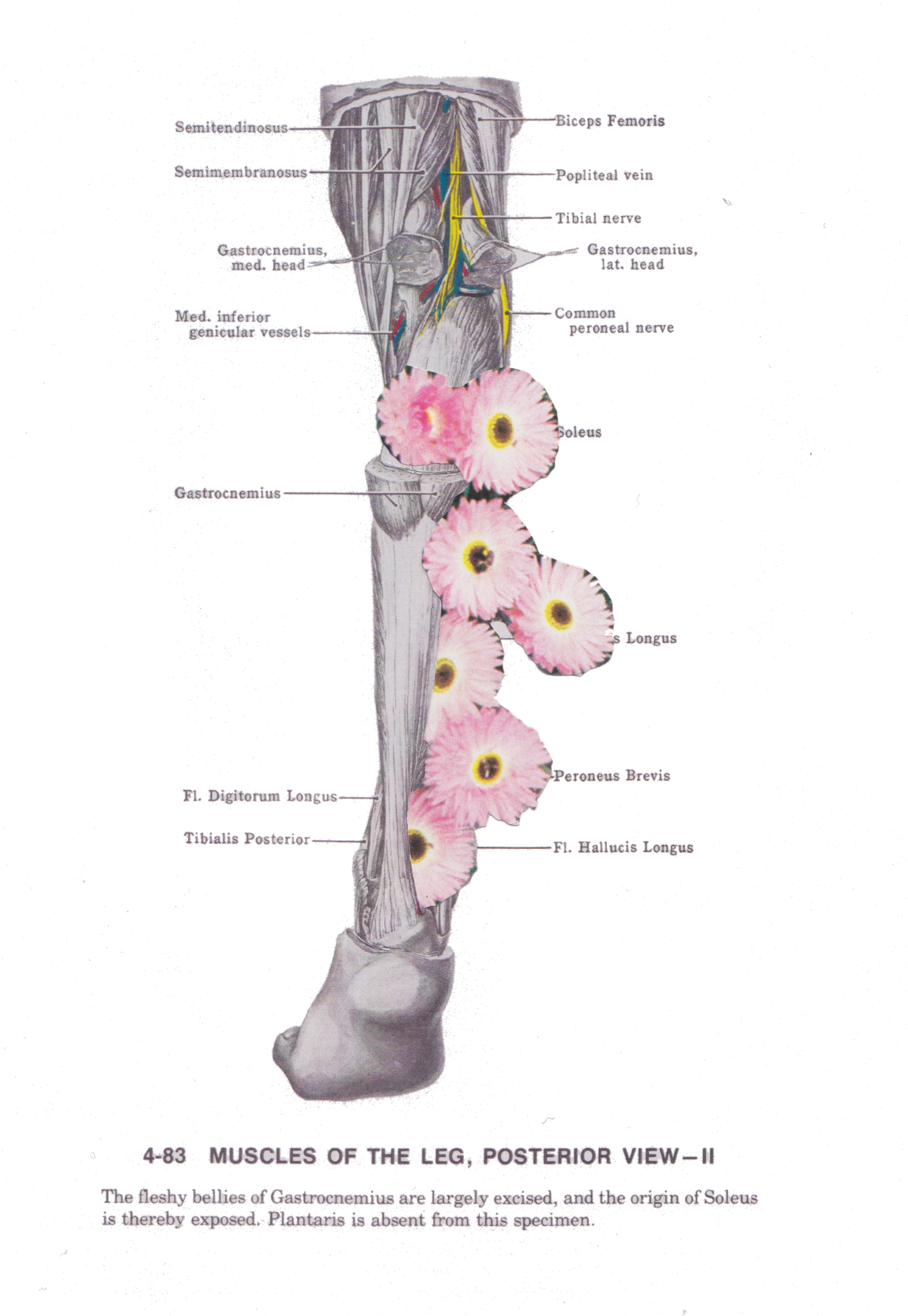 Anatomical Collages - kthps