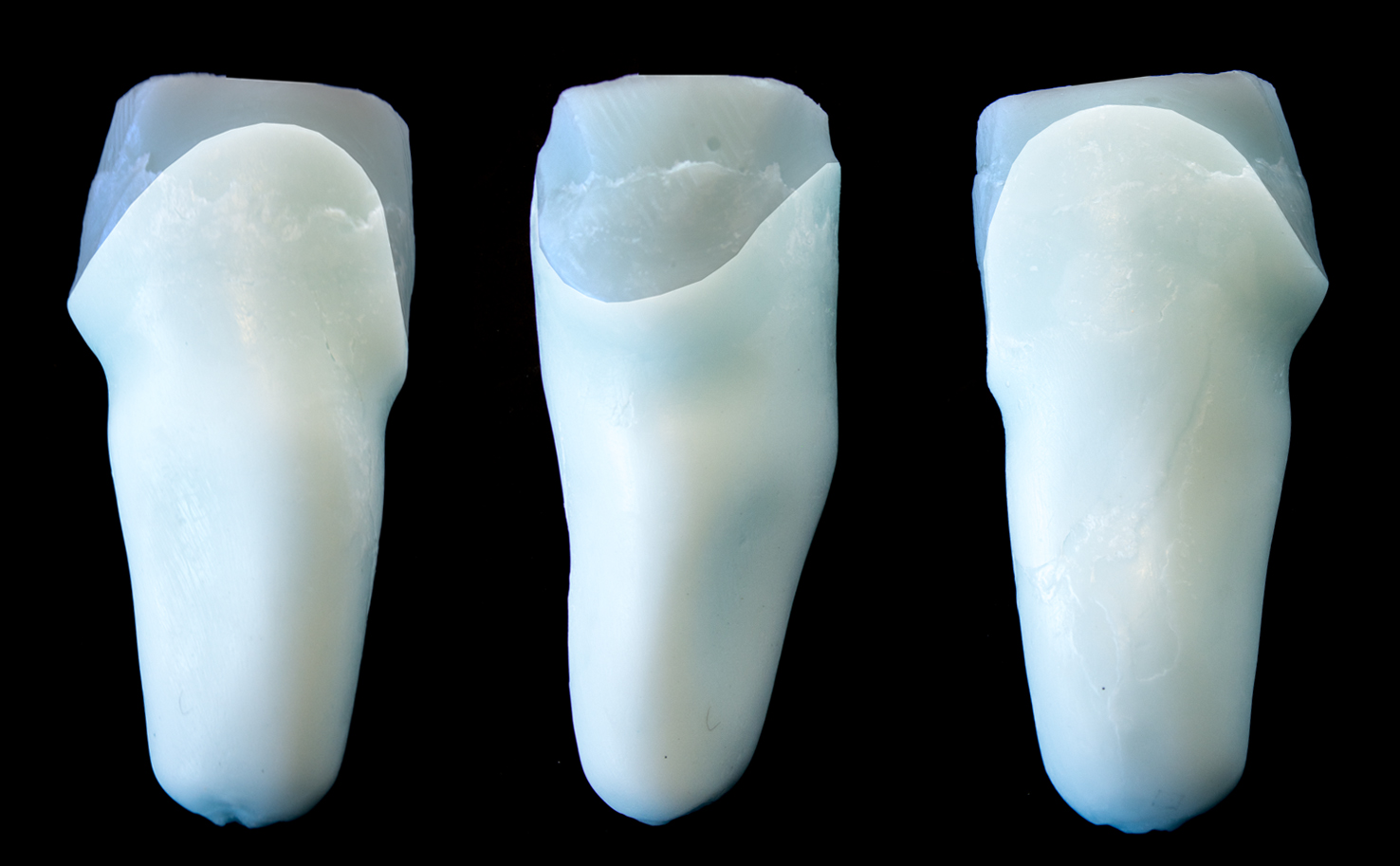 Prosthetic Socket - nomadicform