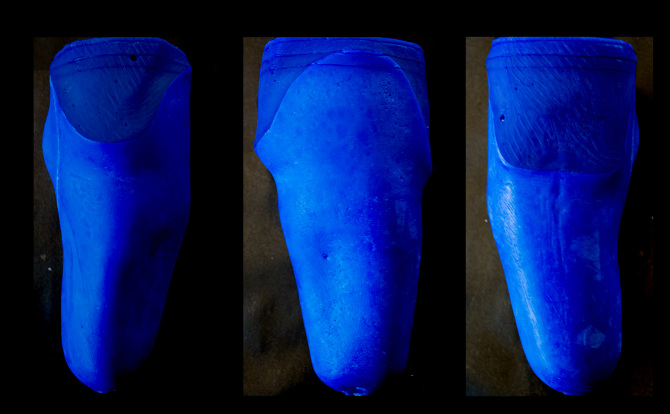 Prosthetic Socket - nomadicform