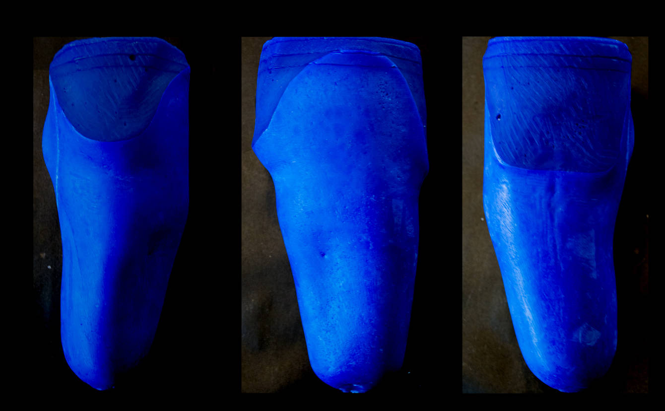 Prosthetic Socket - nomadicform