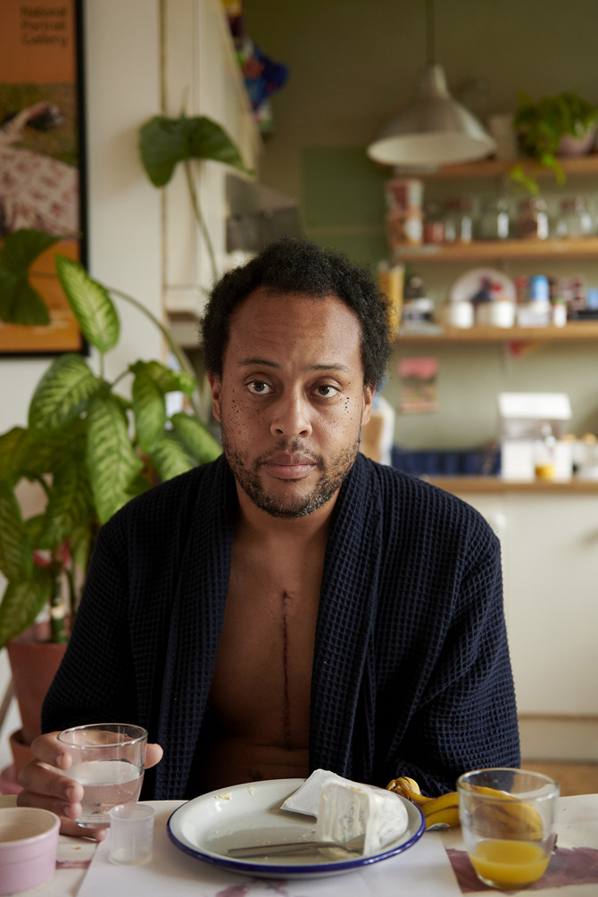 Portrait of Britain Winner 2021: Michael - 11 days post-surgery - Gwen ...