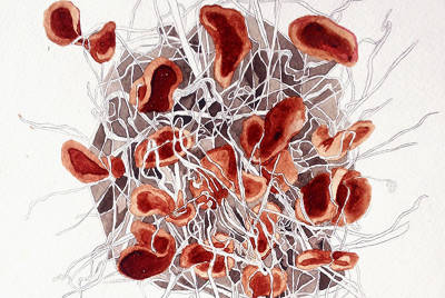 factor XIII - ash conrad