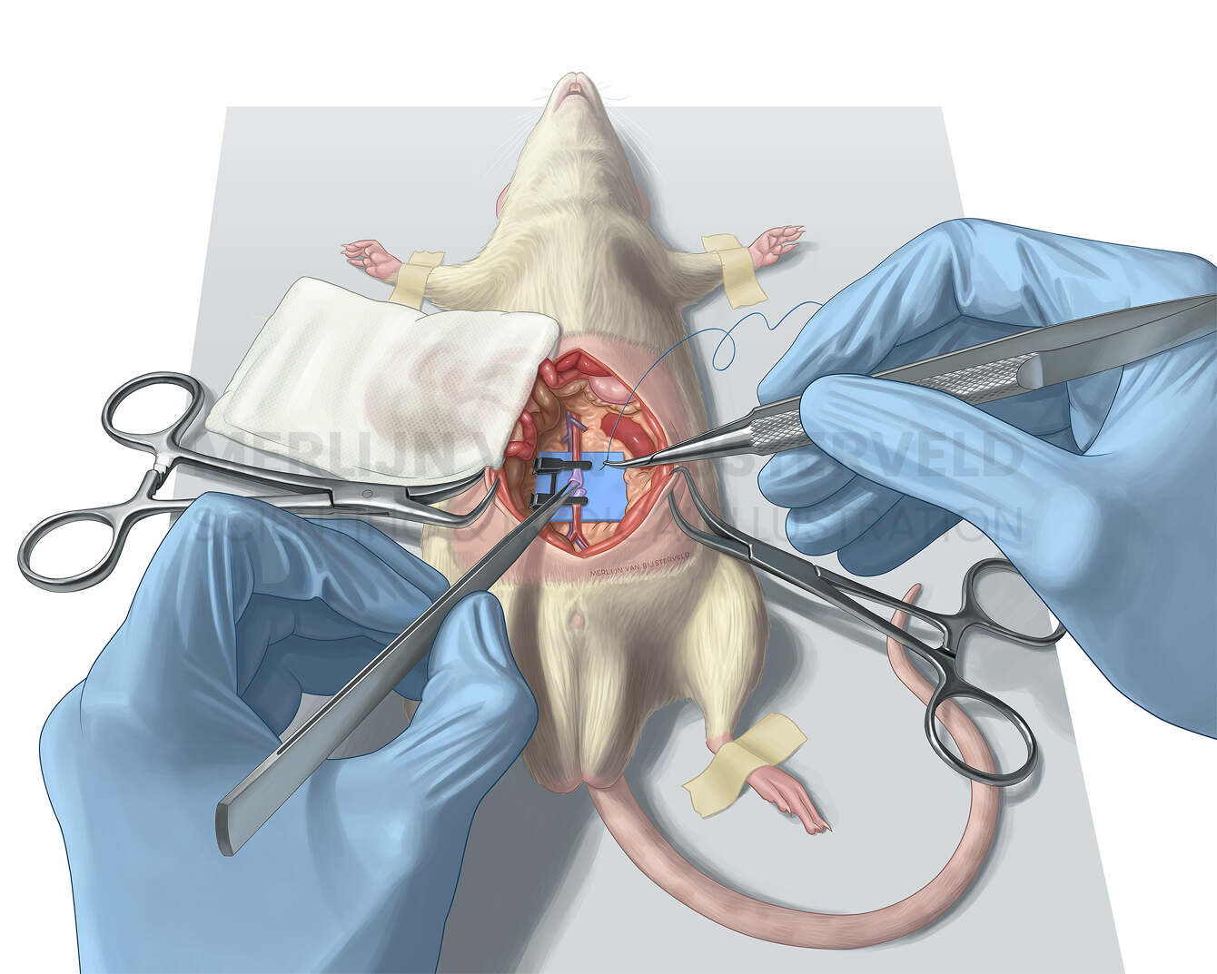 Surgery - Merlijn van Bijsterveld Illustration