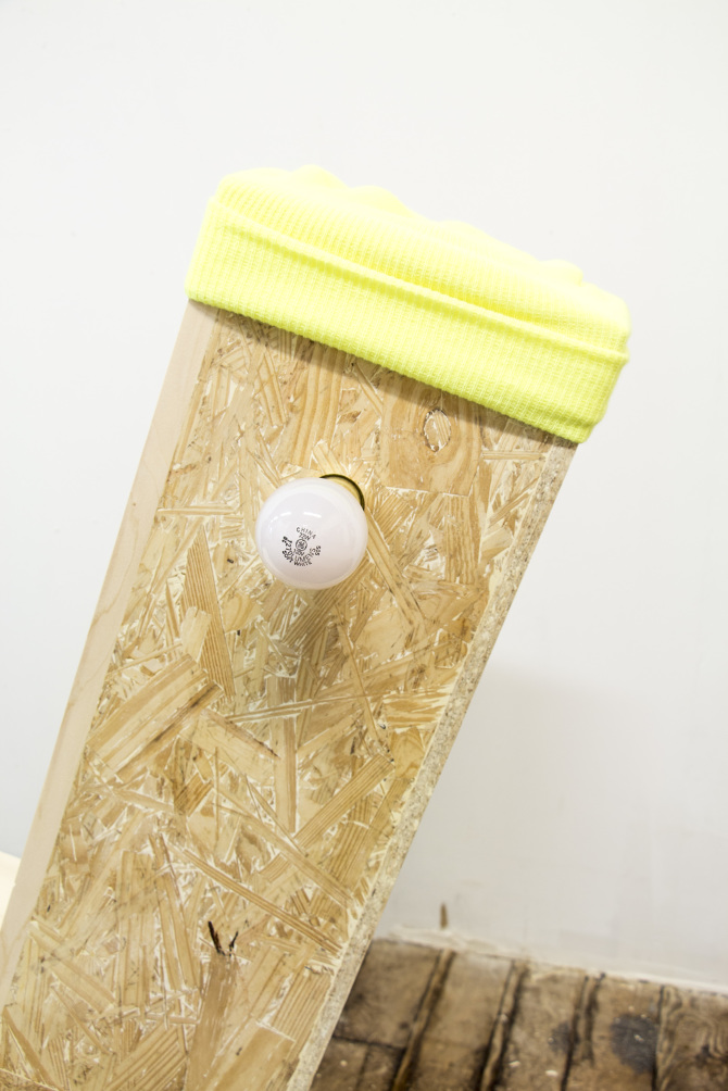 Forever Busted Leg - alexgartelmann.com