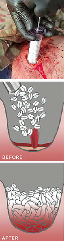 XStat Hemostatic Sponge - Future Health Systems
