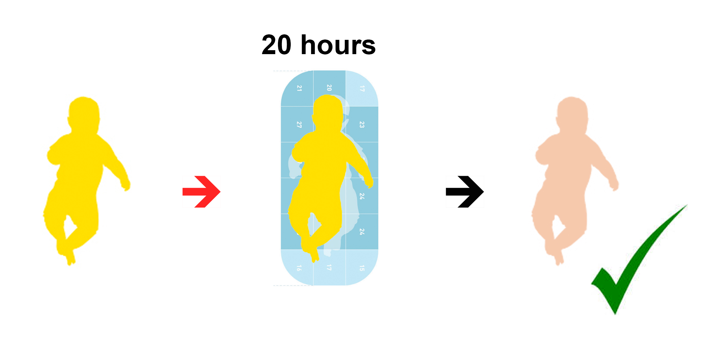 Firefly Phototherapy Device - Future Health Systems