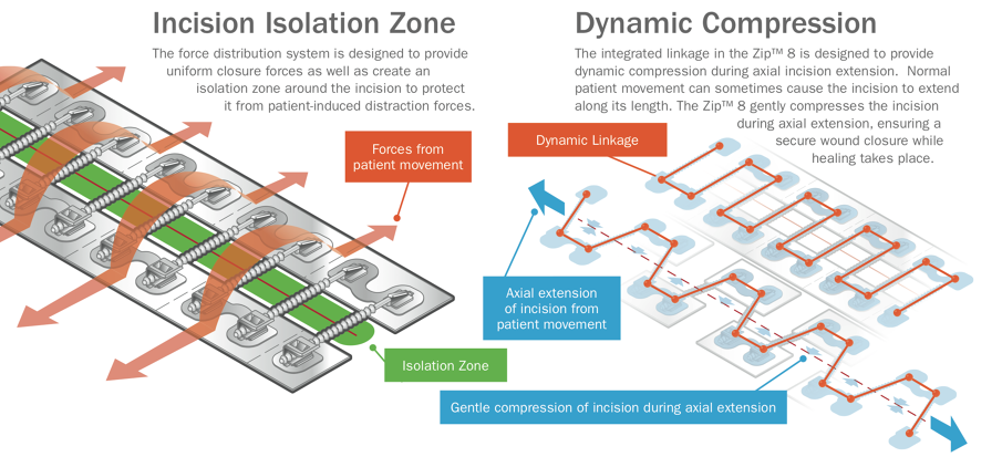 Zip 8 / 16 Surgical Skin Closure - Future Health Systems