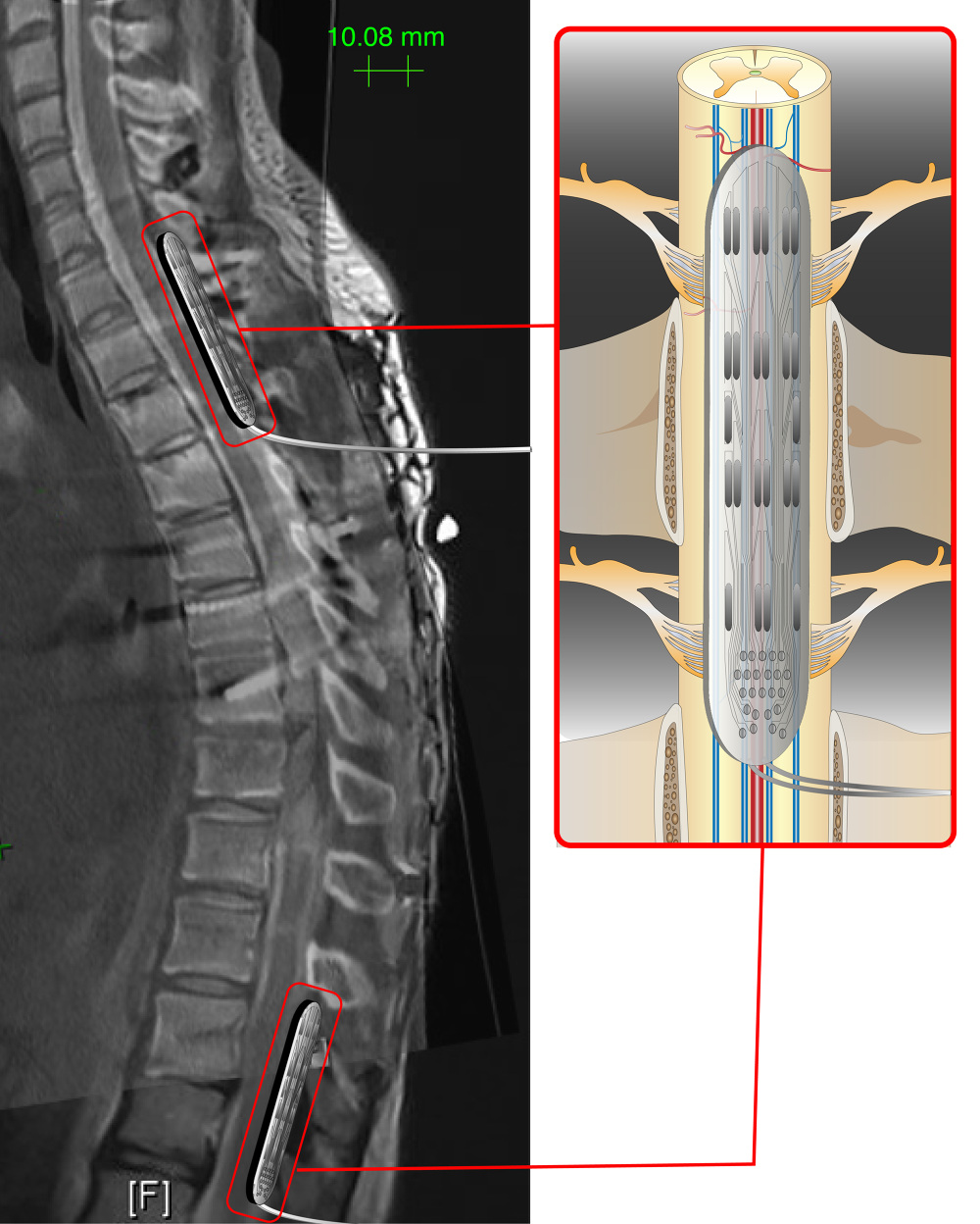 Medical Illustrations - Kendall Lane