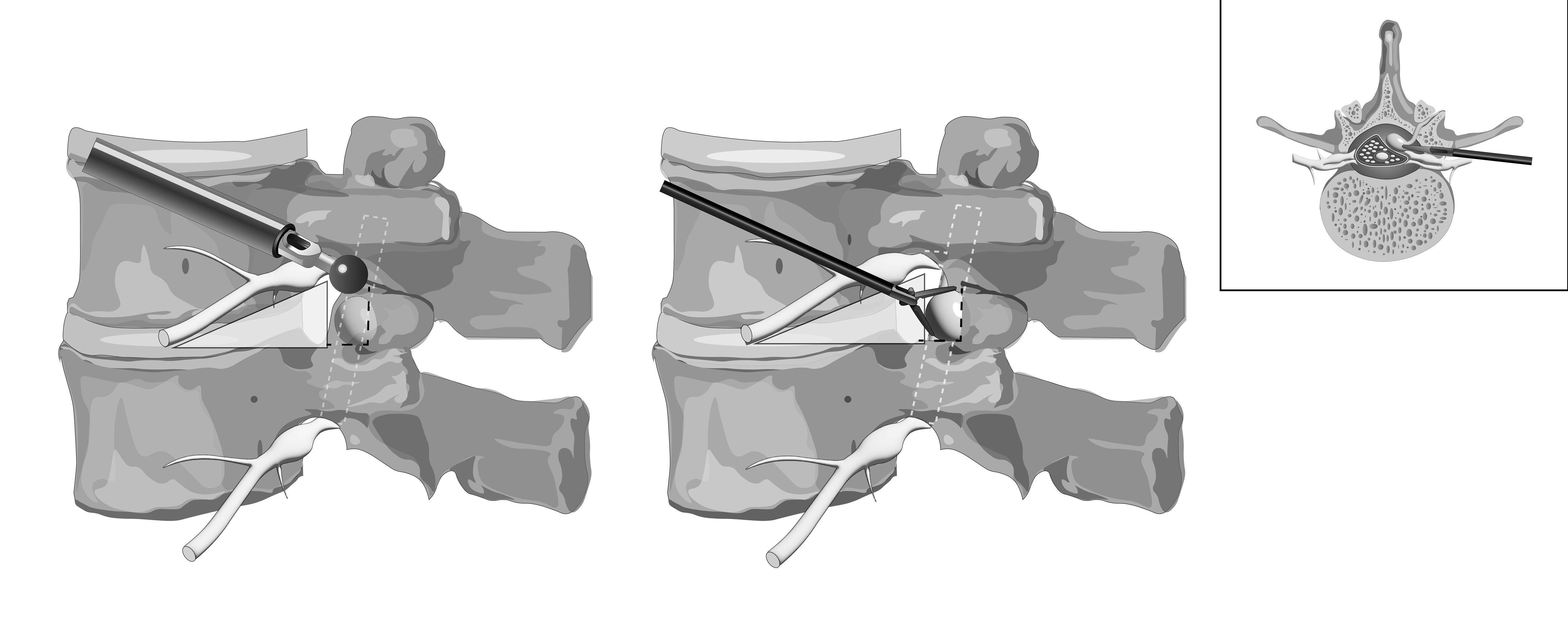 Medical Illustrations - Kendall Lane
