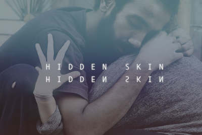 Hidden Skin ~ Short Film - Udit Nijhawan