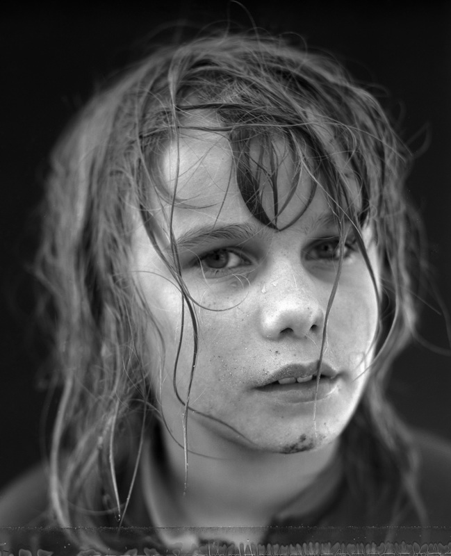 Surfer's Healing - Mason Poole