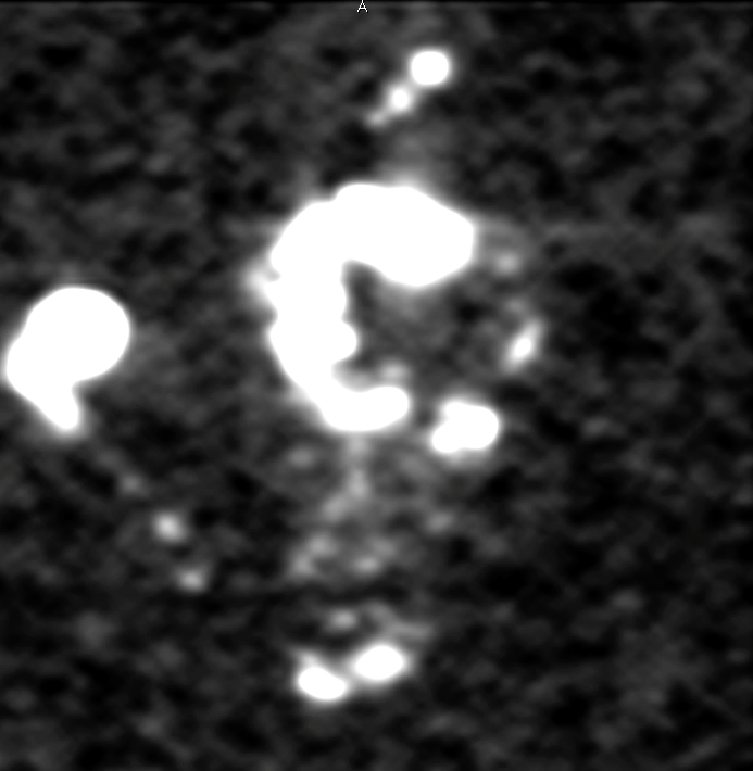 Scanning MRI phantoms - jennifercrouch