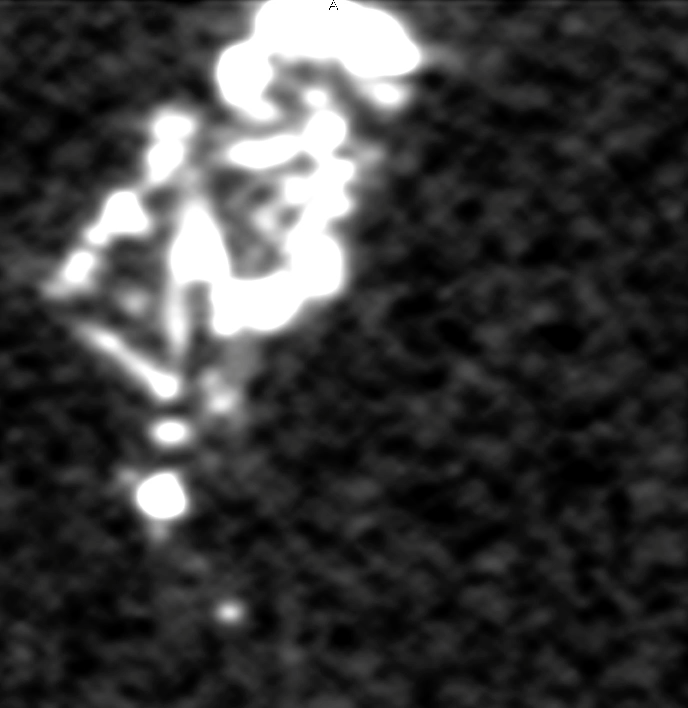 Scanning MRI phantoms - jennifercrouch