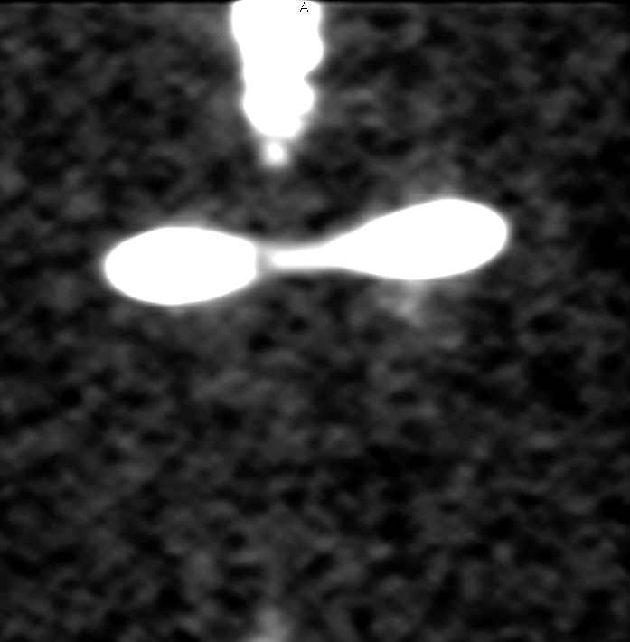 Scanning MRI phantoms - jennifercrouch