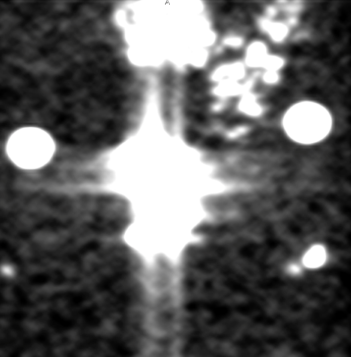 Scanning MRI phantoms - jennifercrouch