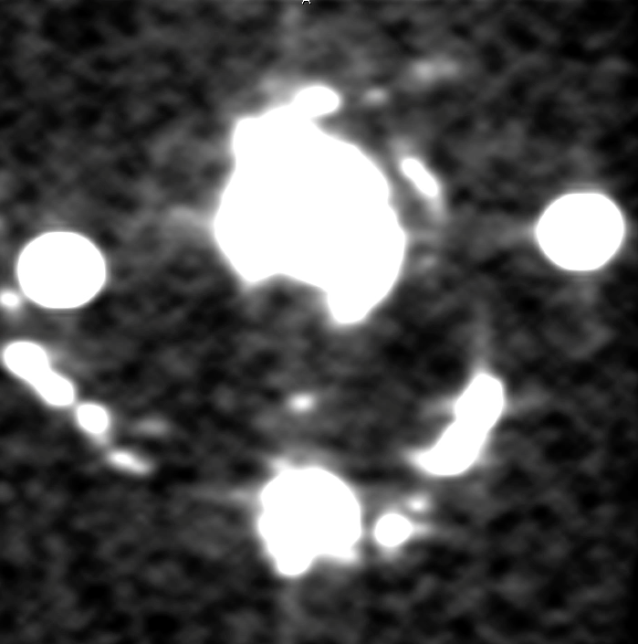 Scanning MRI phantoms - jennifercrouch