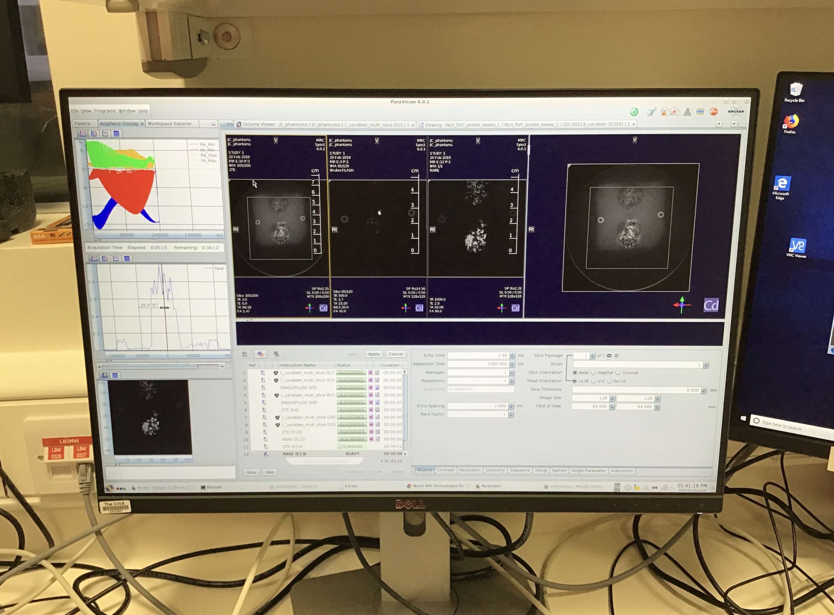 Scanning MRI phantoms - jennifercrouch
