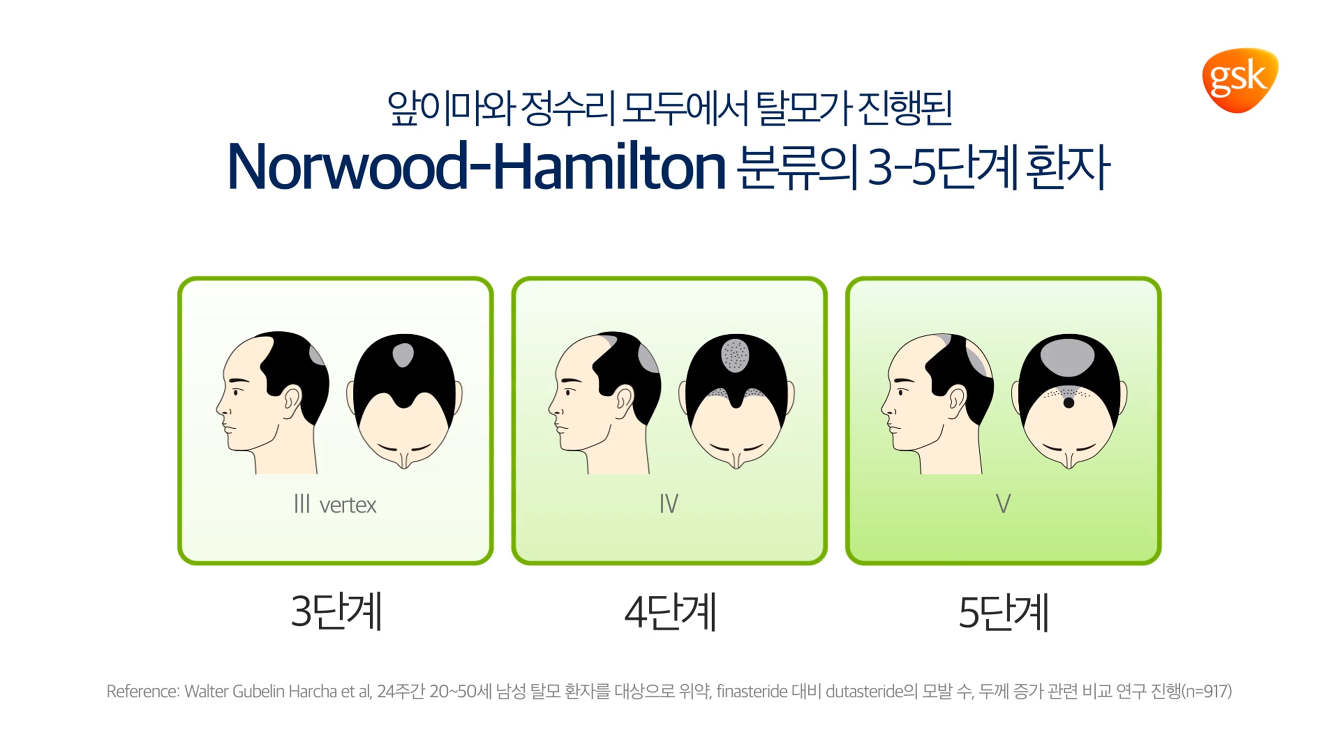 GSK AVODART - www.paranoidscene.com