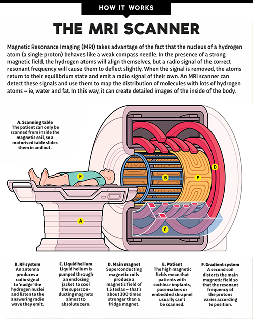 MRI Scanner - Raja Lockey Illustration