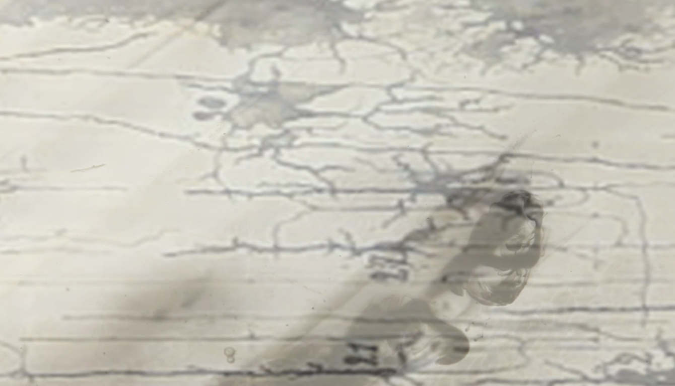 Pain under the Microscope - Deborah Padfield