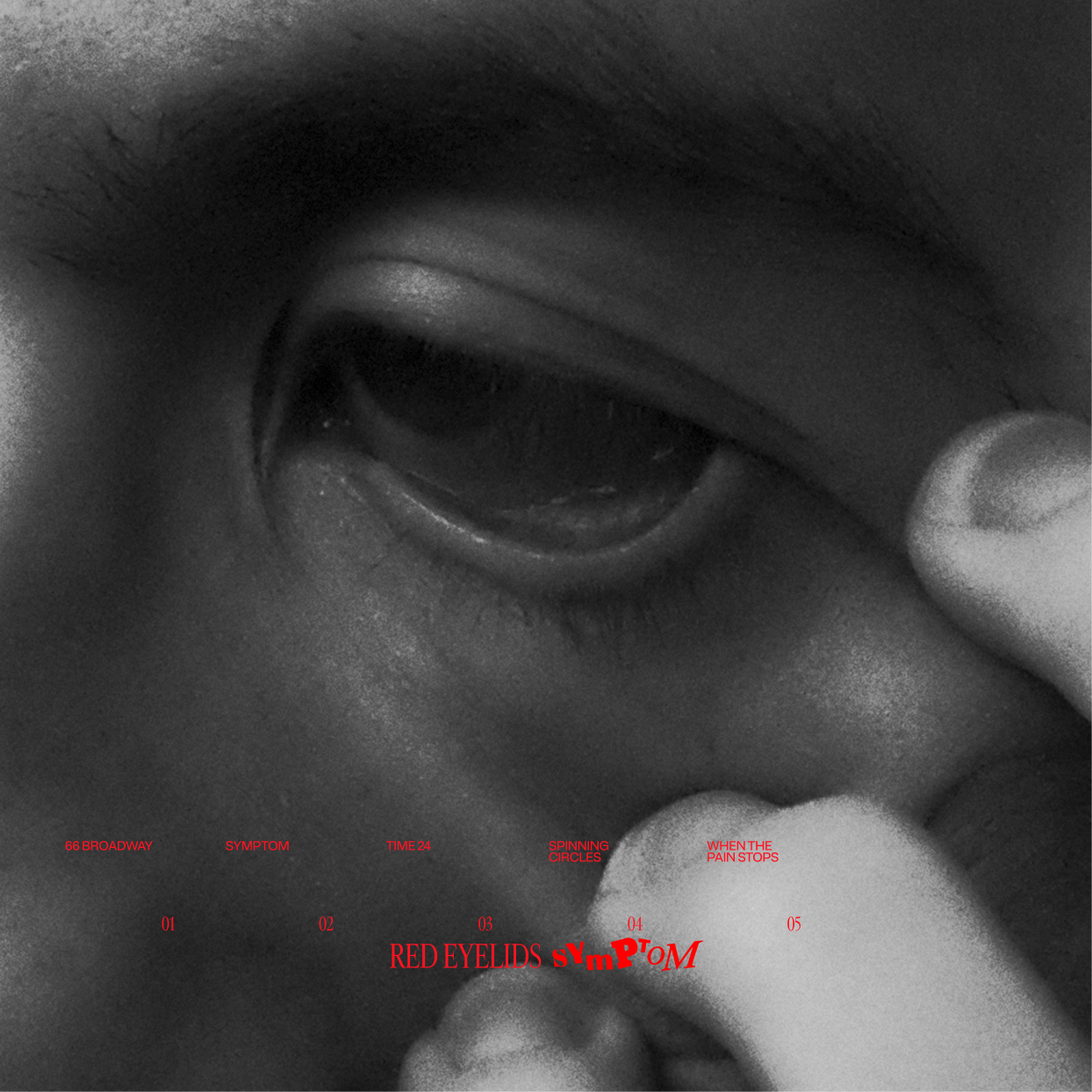 symptom-red-eyelids
