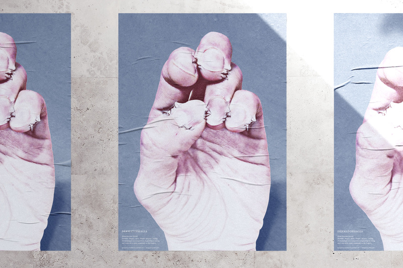 DERMATOPHAGIA - DIOLAU