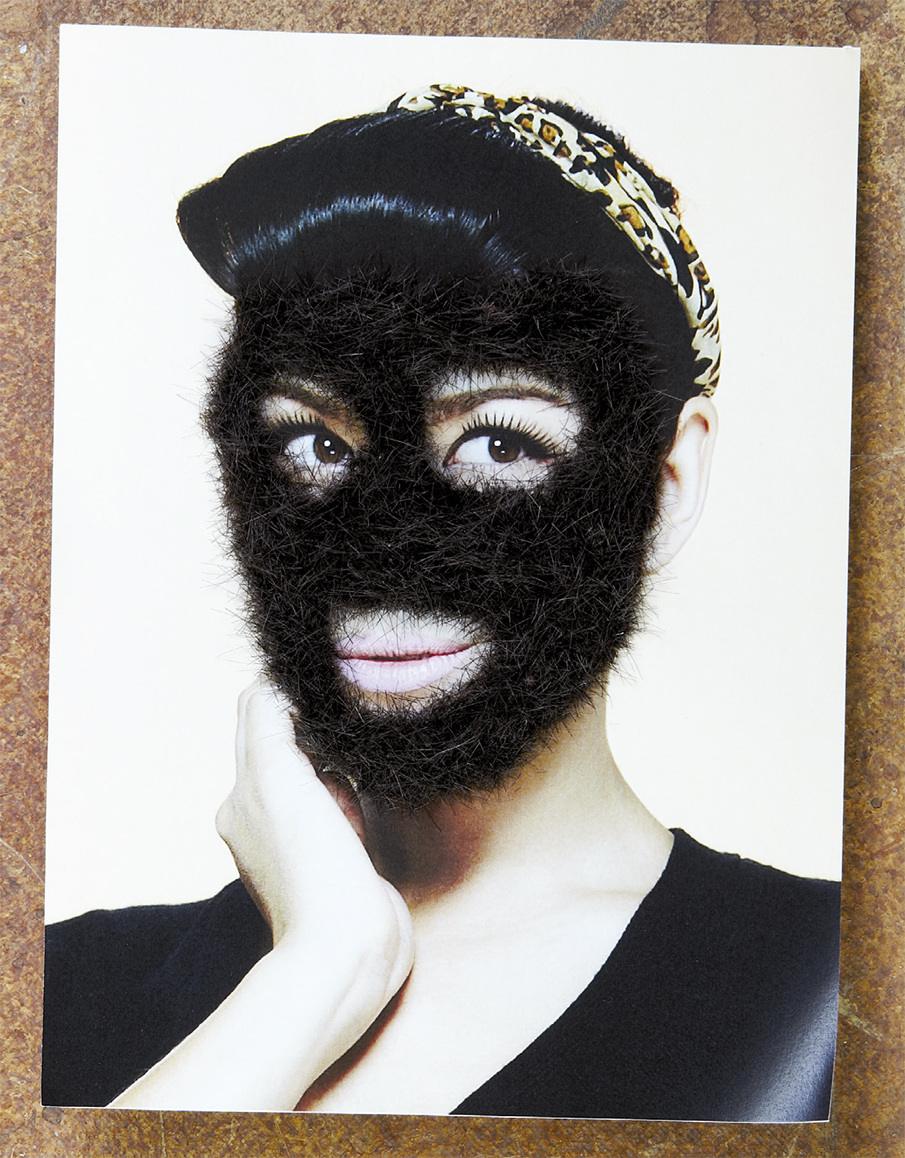 Hypertrichosis - Rebecca Chew