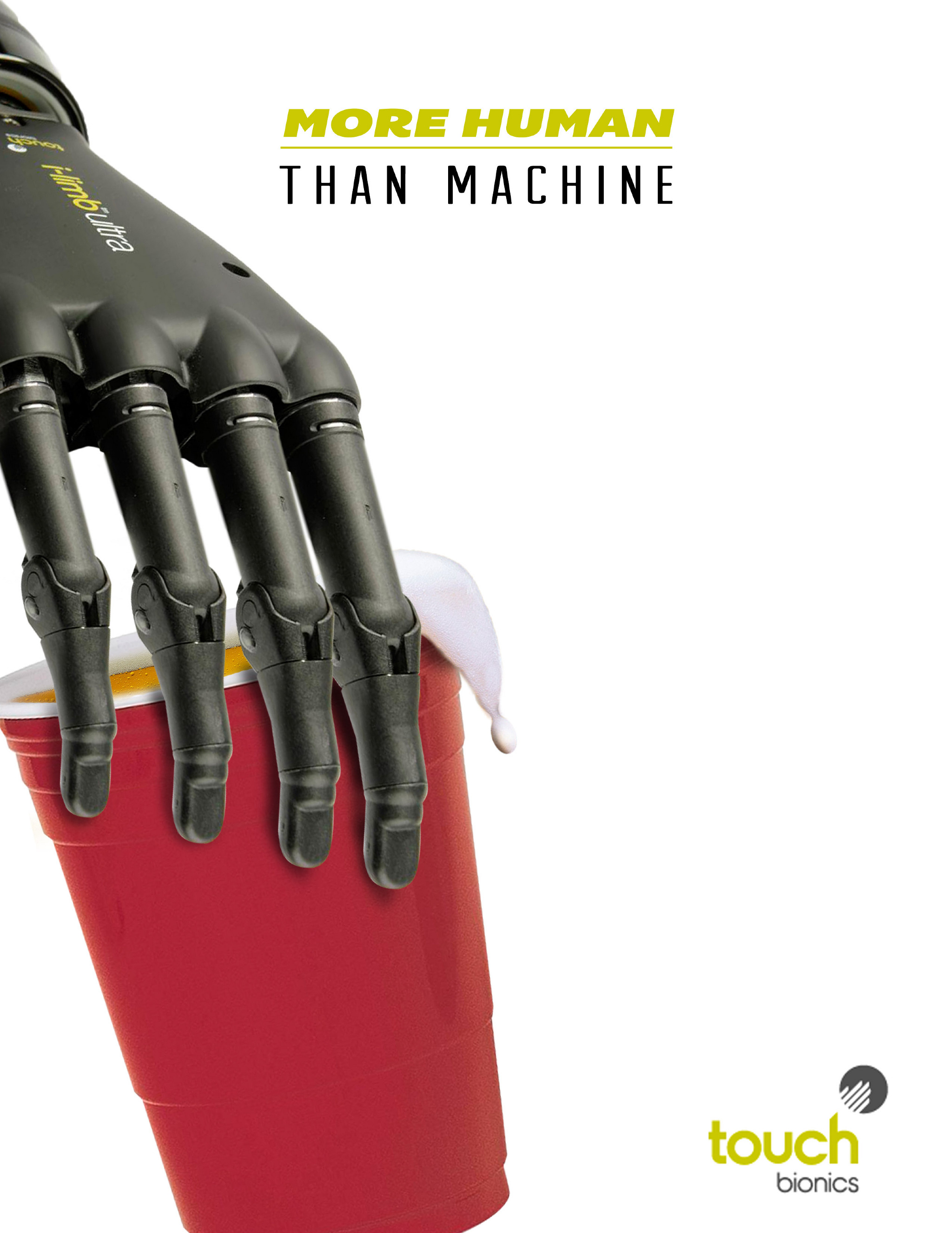 iLIMB, Touch Bionics - peterhouser