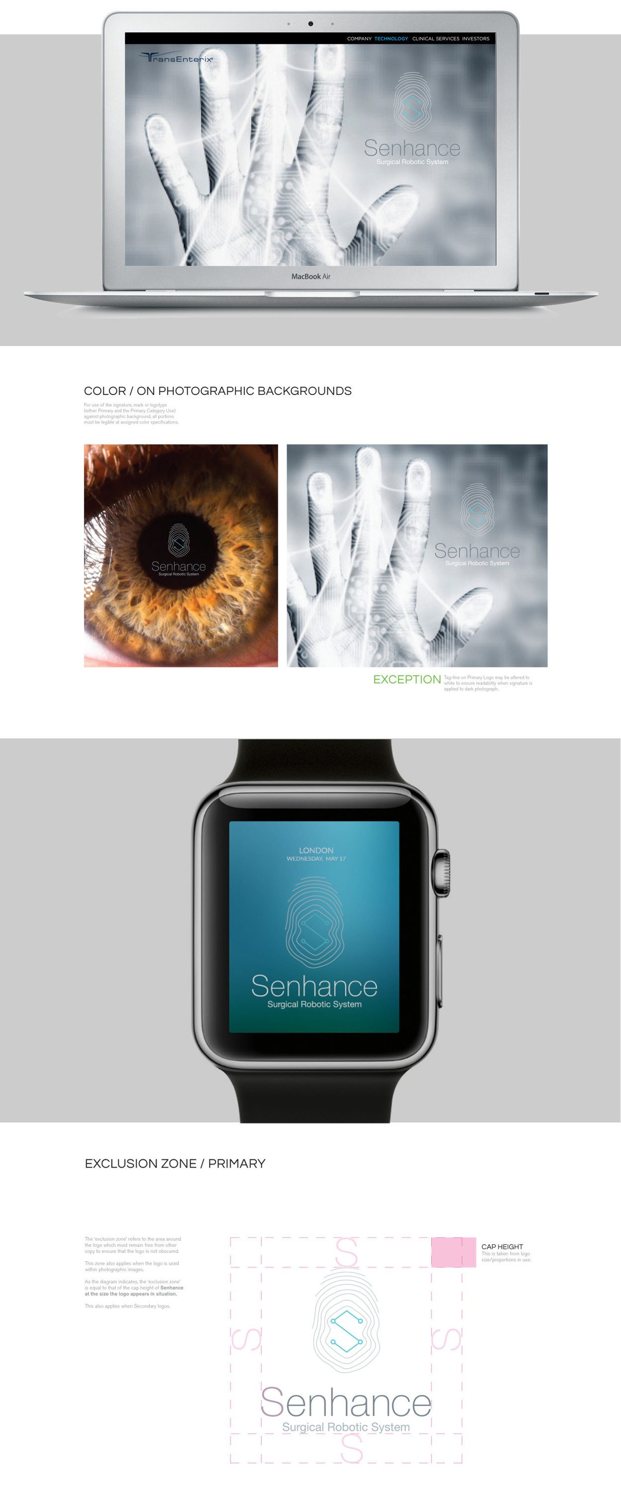 Senhance Robot - Irasema Design