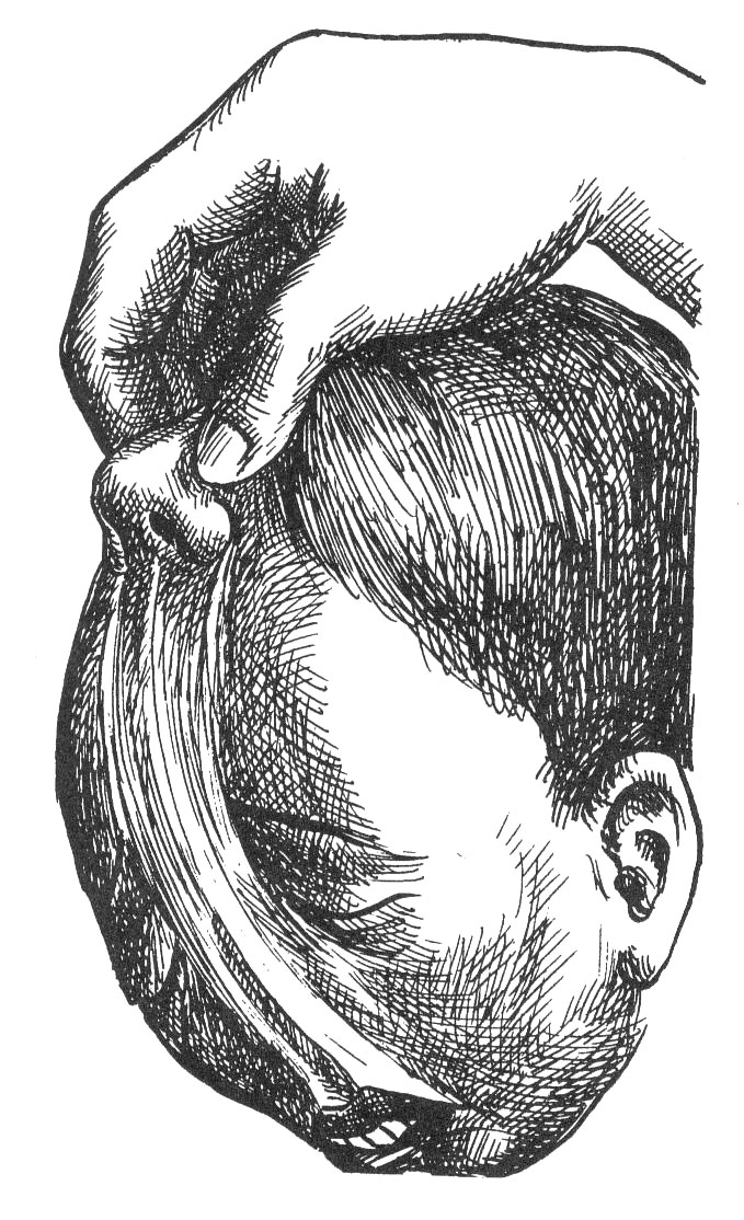 Roland Topor - Kunstkabinett