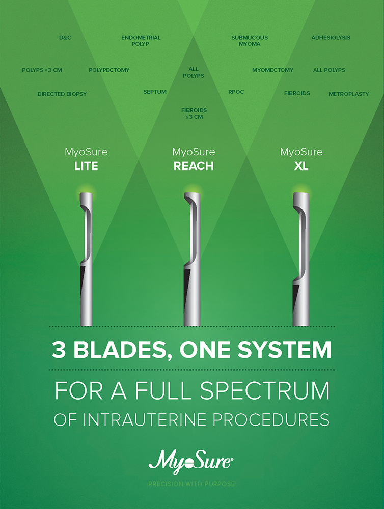 MyoSure - Kira Hadalski