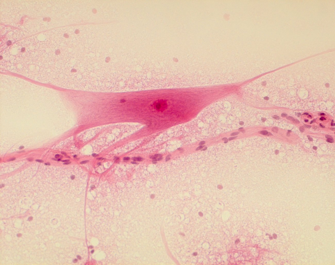 neural tissue, slideshow - synapses