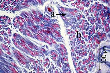 nerve tissue, epithelial - synapses