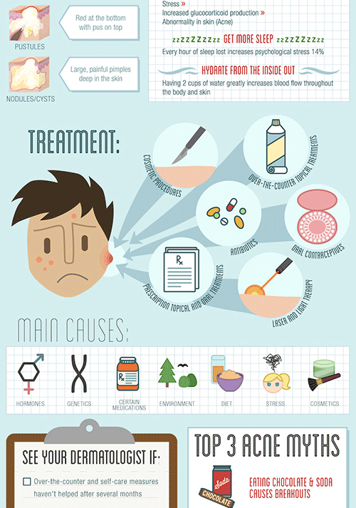 Four Points Dermatology Infographics - Kelsey Spencer // Illustration ...